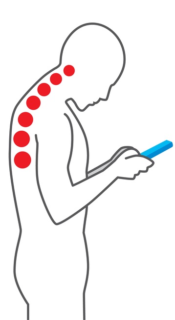 Texting posture st louis chiropractor - Smart Pain Solutions